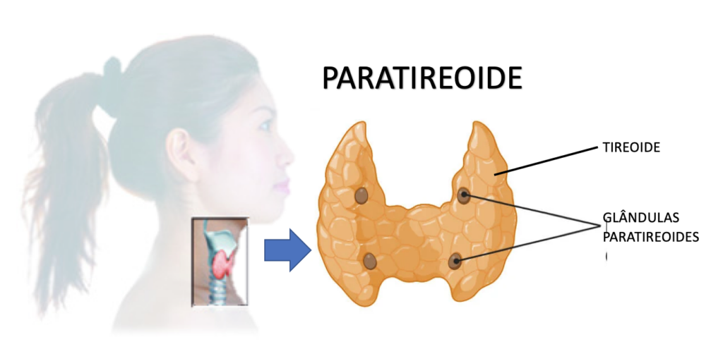 Adenoma de Paratireoide - Medicina de Excelência