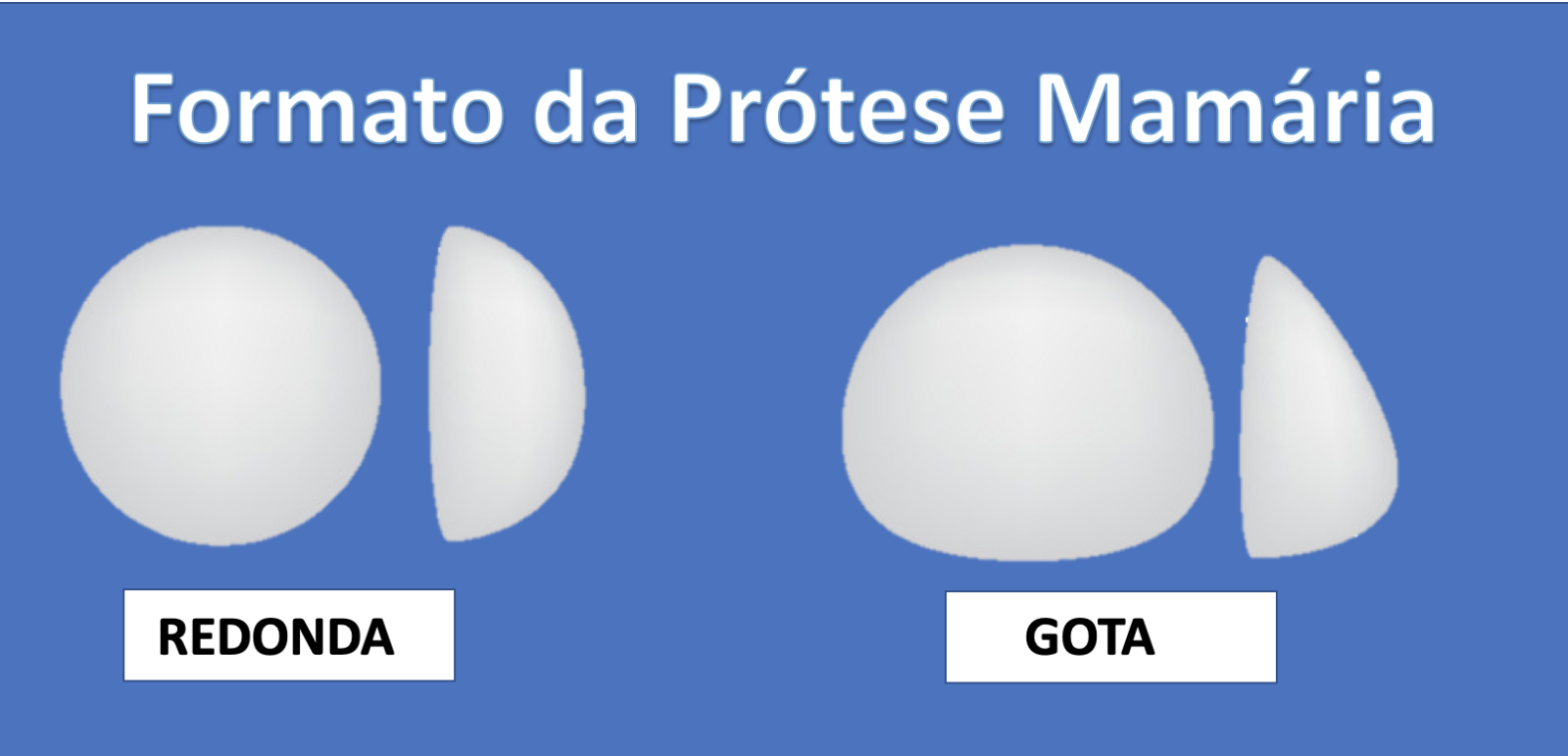 Prótese mamária (prótese de silicone) - Medicina de Excelência