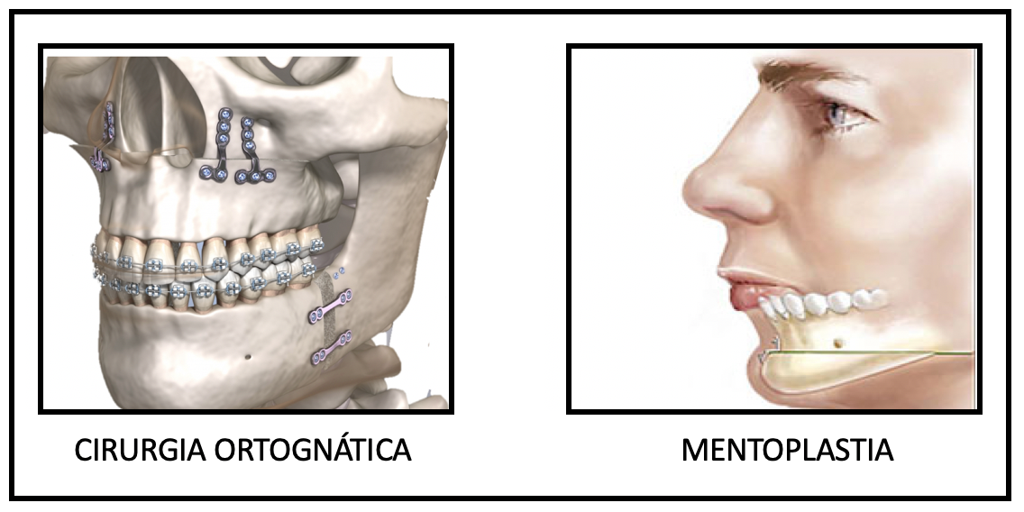 Cirurgia Ortognática - Medicina de Excelência