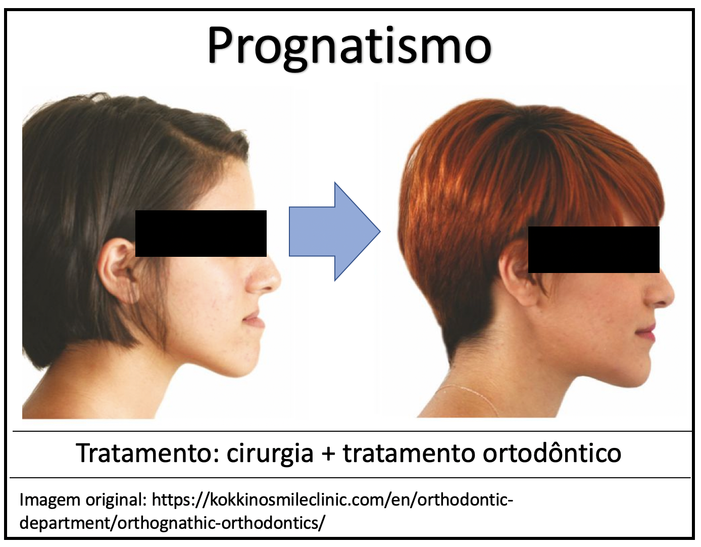 Cirurgia Ortognática - Medicina de Excelência