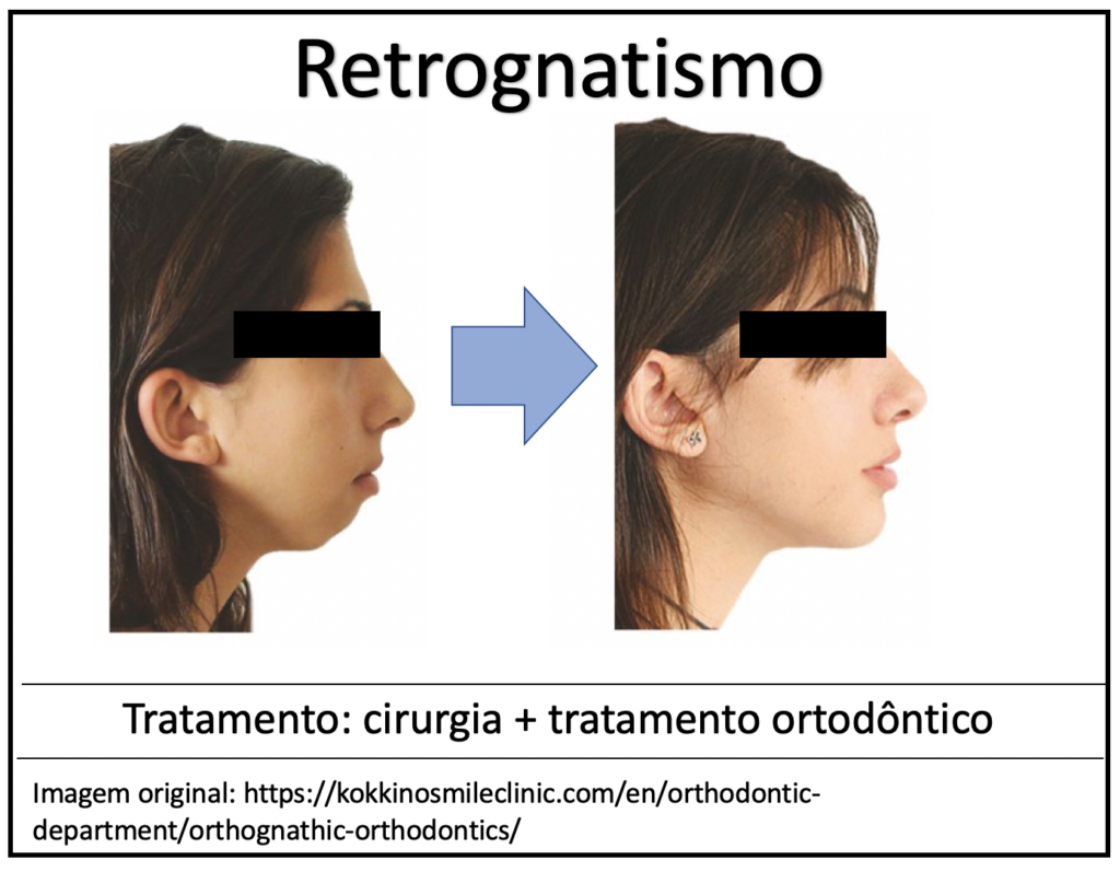 Cirurgia Ortognática - Medicina de Excelência
