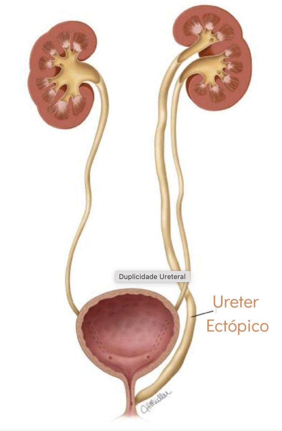 Malformações geniturinárias - Medicina de Excelência