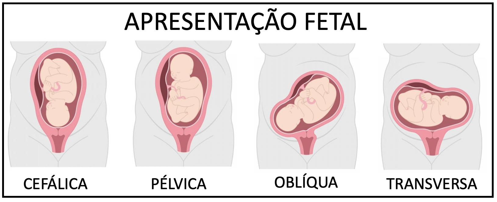 Apresentação Fetal - Medicina de Excelência